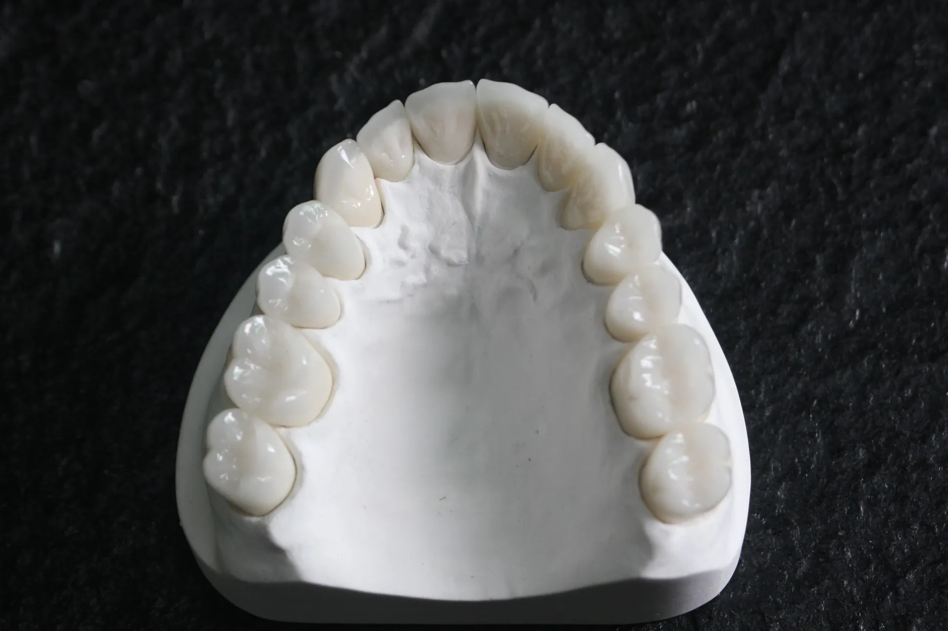 Dental Crowns, Implant, Zirconia, PFM, Denture | Company Name