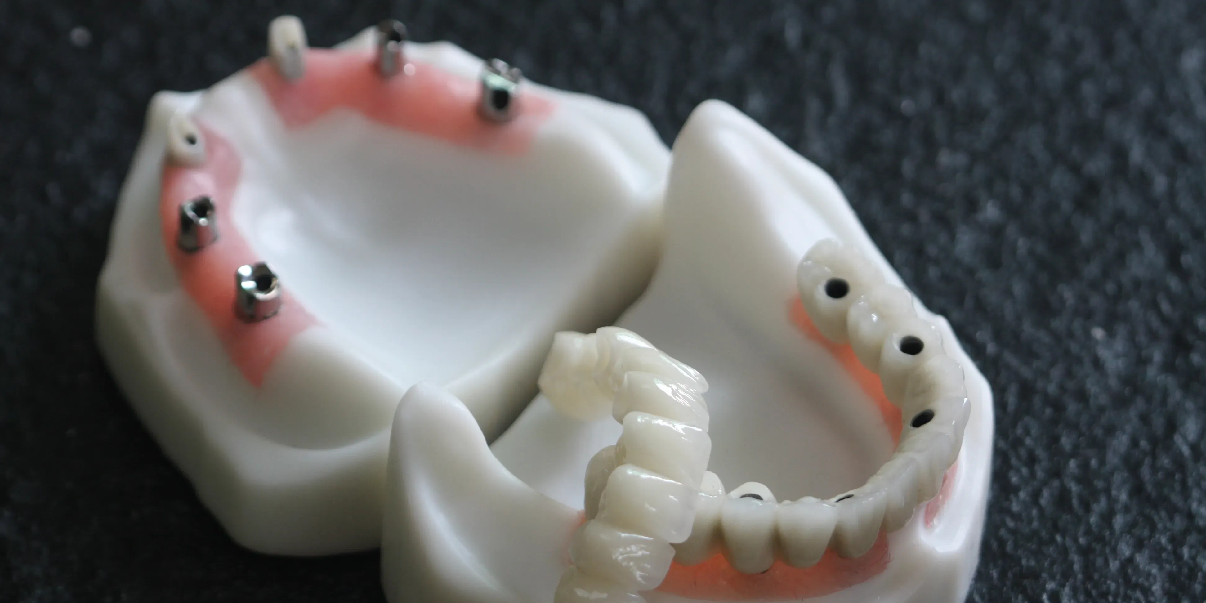 Dental Crowns, Implant, Zirconia, PFM, Denture | Company Name